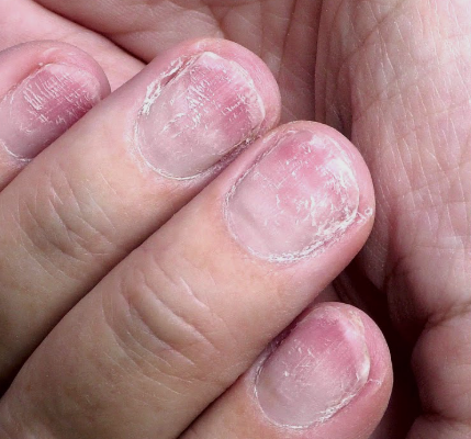 Strong Nails Without BIAB or extensions - Dermatologist Tests 4 Soluti ...